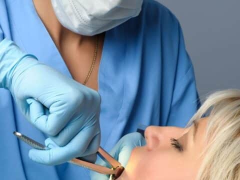 Wisdom teeth Removal in Katy & Houston | Same Day Extraction | Walk-In ...